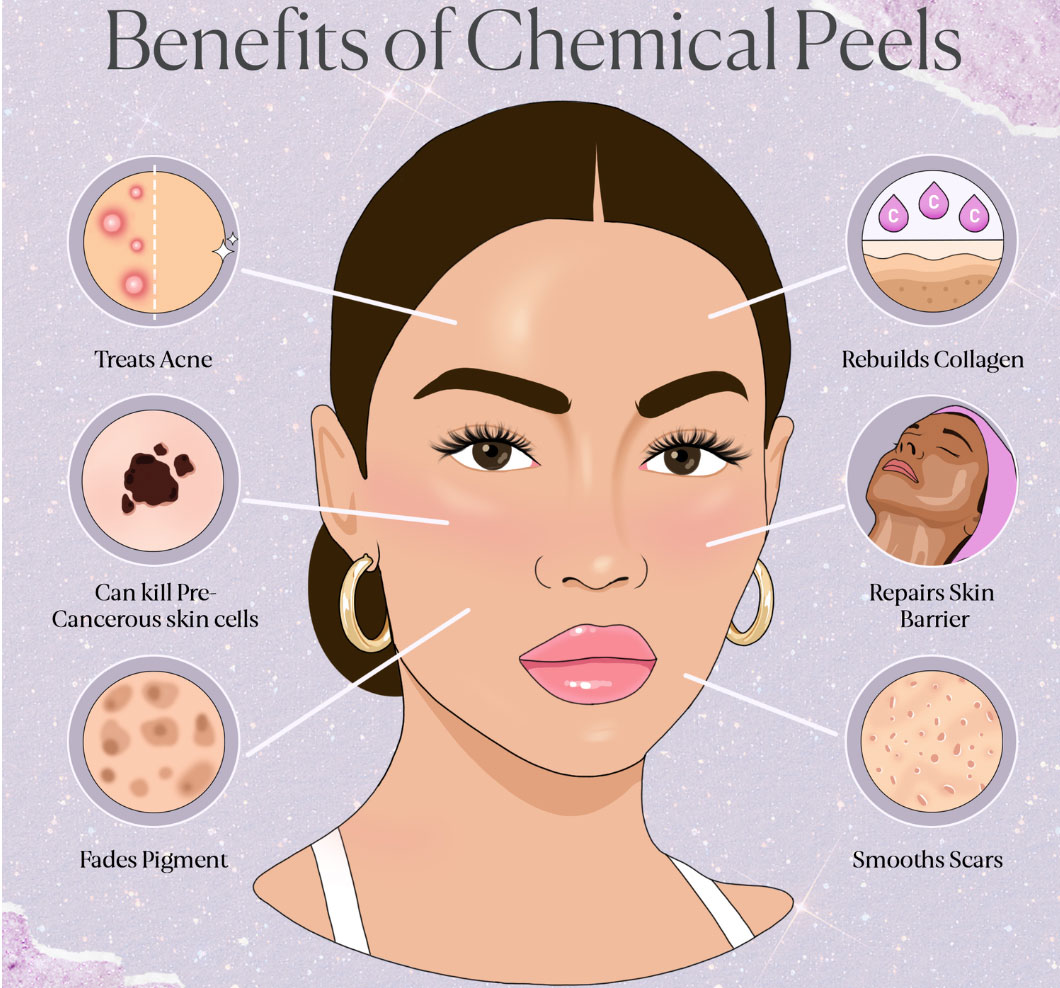 Facial Chemical Peels Services in Upland CA | Alma Oasis Med Spa